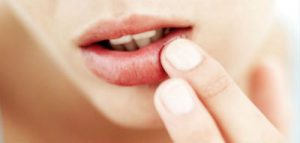 Labios Secos - 12 (Imprescindibles) Consejos para Tratarlos