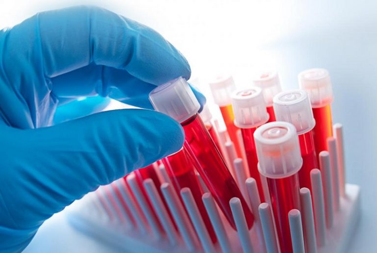 Qué Significa HCM en un Análisis de Sangre - EsLife