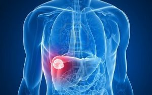 GOT AST: Qué Significa en un Análisis de Sangre - EsLife