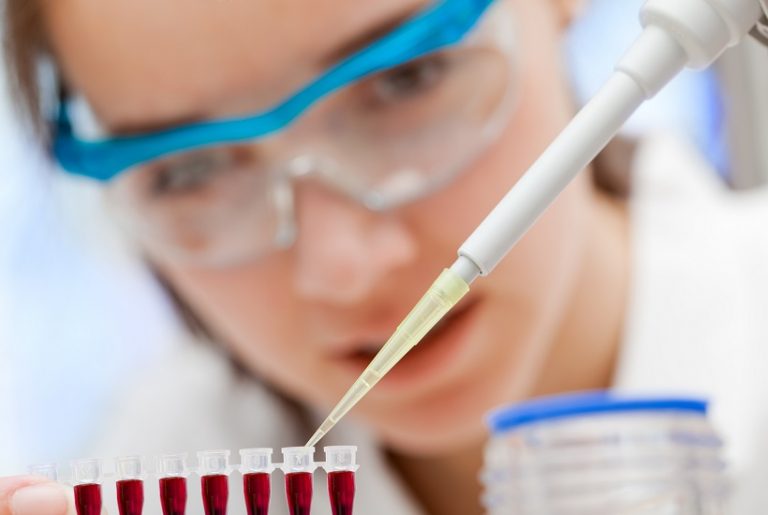 GOT AST: Qué Significa en un Análisis de Sangre - EsLife