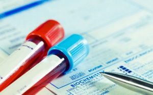 GOT AST: Qué Significa en un Análisis de Sangre - EsLife